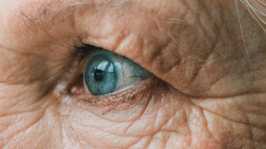 Common Causes of Sight Loss | Dolphin Computer Access